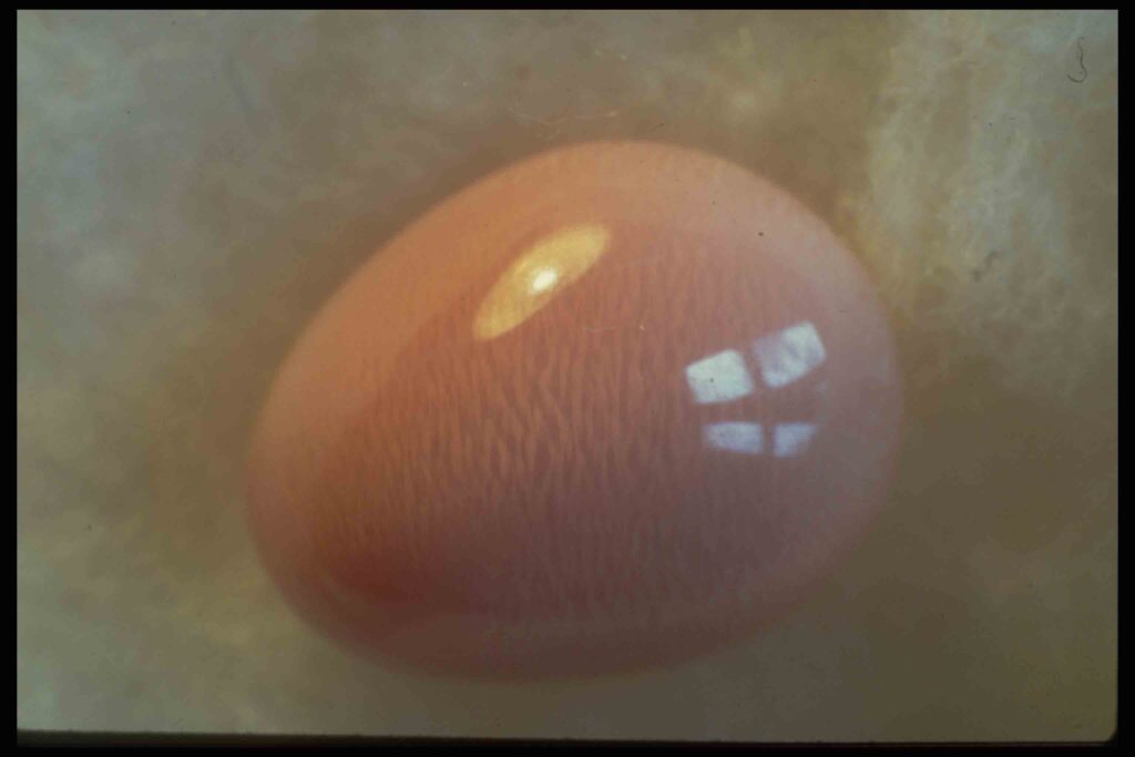 Understanding Rare Non-Nacreous Pearls | Gem-A